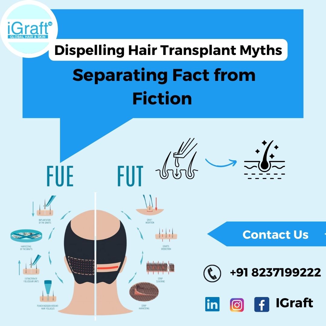 Dispelling Hair Transplant Myths: Separating Fact from Fiction