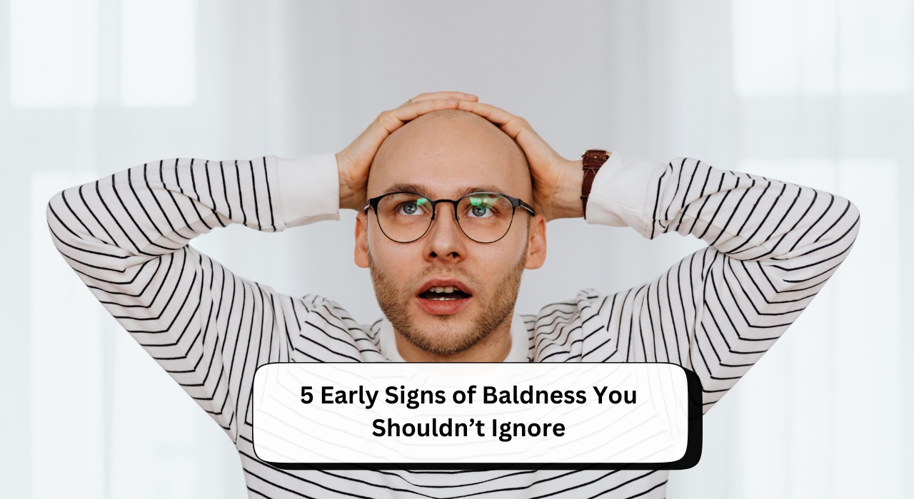 5 Early Signs of Baldness You Shouldn’t Ignore